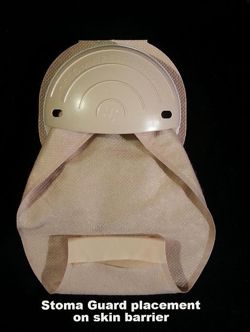 Stoma Guard 2070 – Osto Group